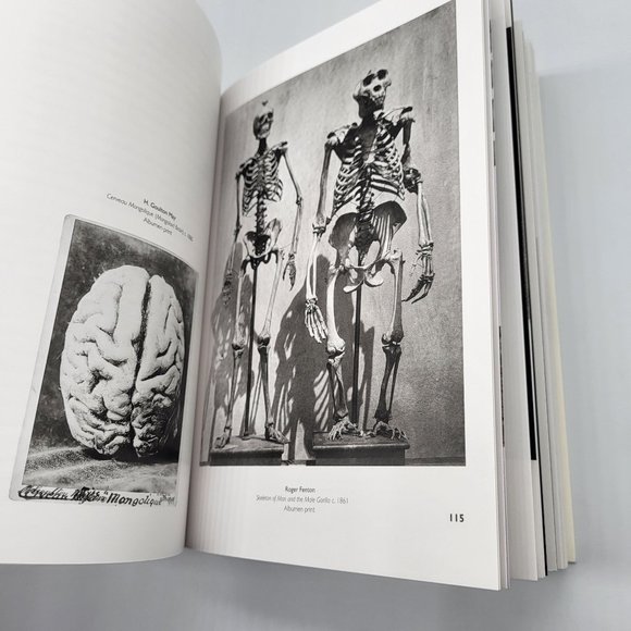 Other | The Body Photographs Of The Human Form By William Ewing ...